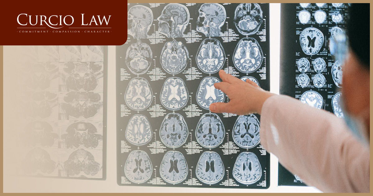 What’s the Recovery Rate of Most Traumatic Brain Injuries? - Curcio Law ...